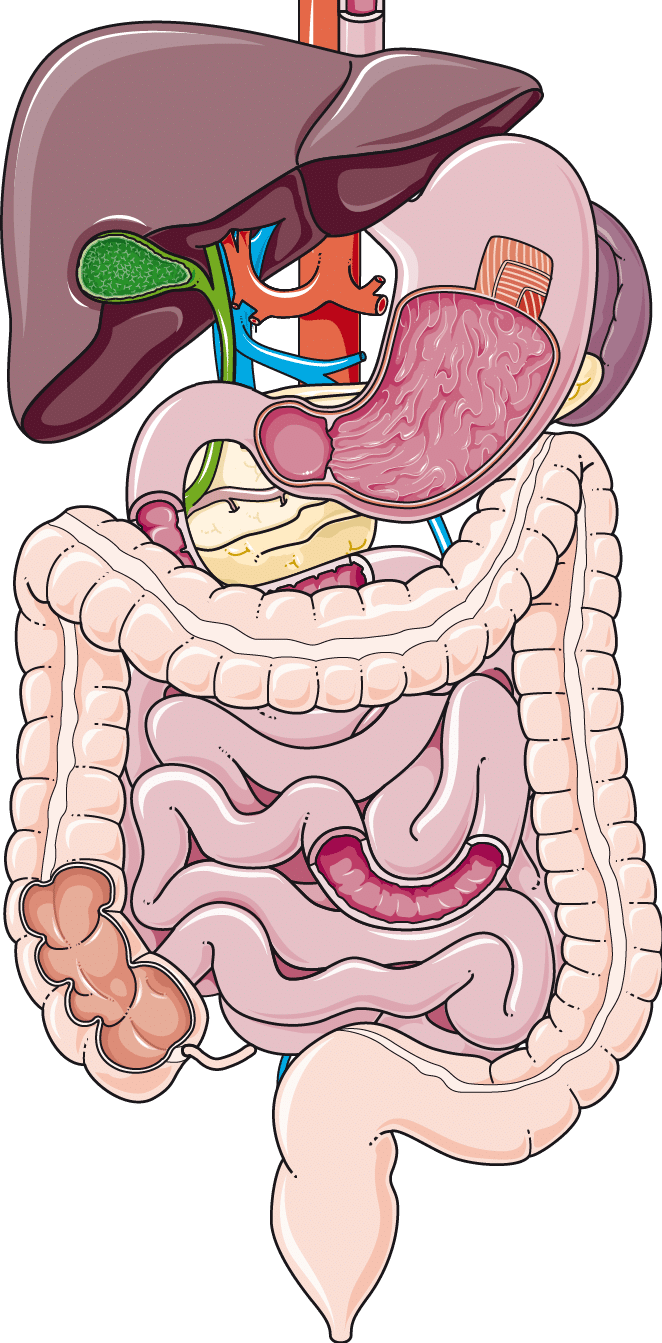 Intestinal failure (continued) - Gut Smart